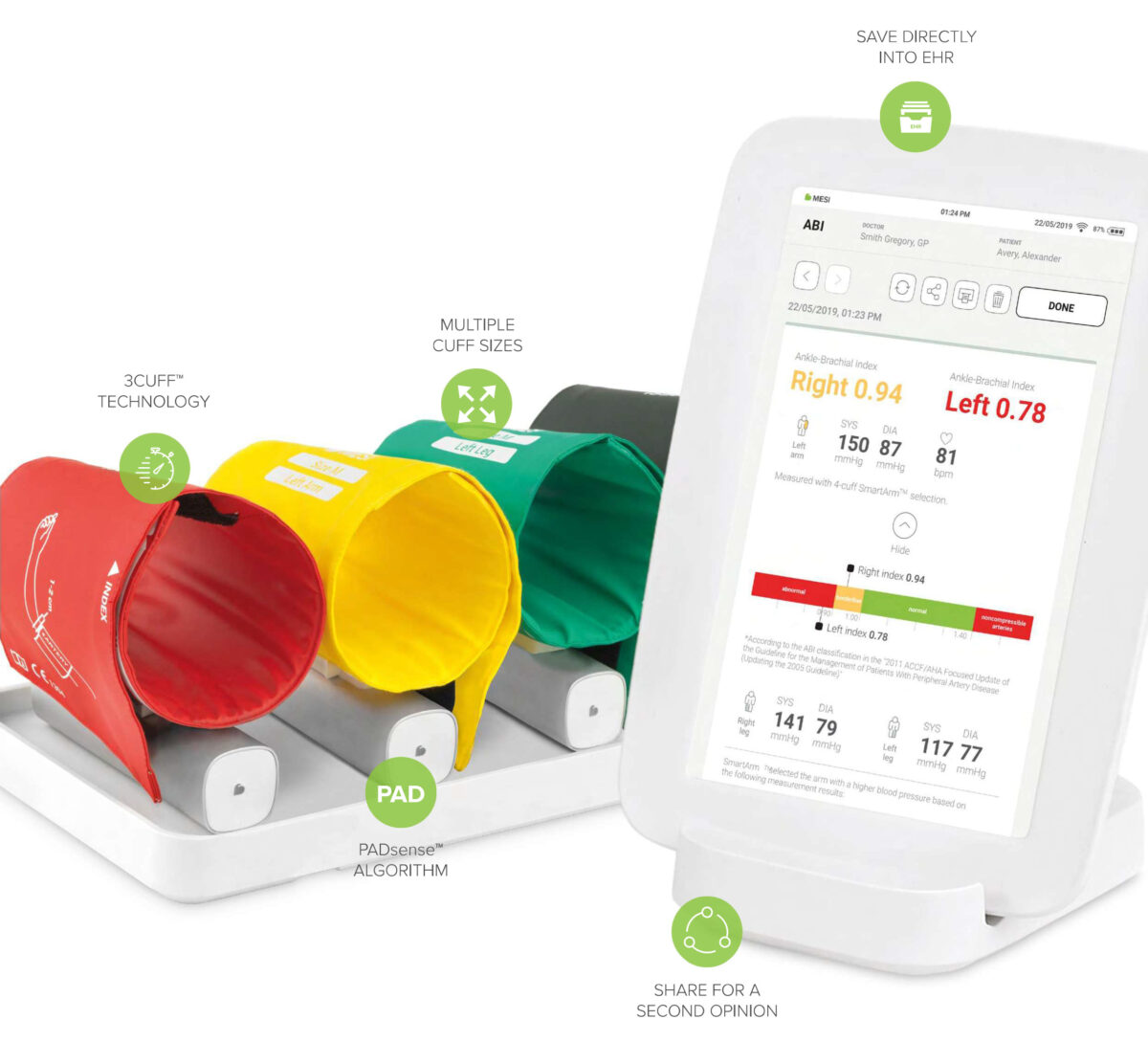Ankle Brachial Pressure Index (ABPI) – Step First Podiatry